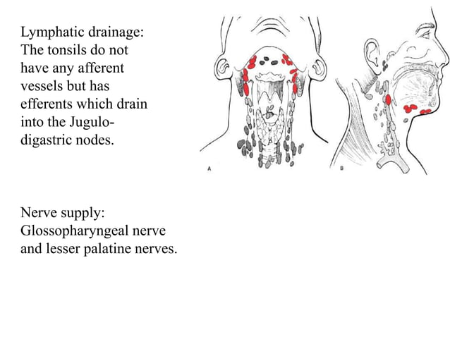 TONSILLITIS | PPTX | Ear, Nose and Throat Conditions | Diseases and ...