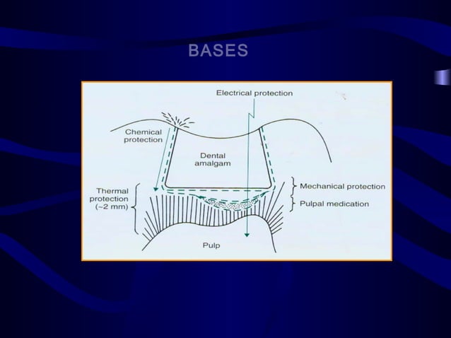 96812770 cavity-liners-and-bases | PPT