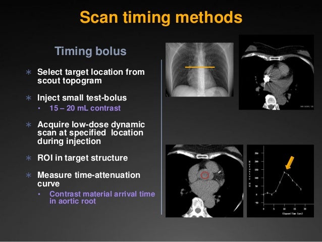 Copy of Mitsumori-CT angiography techniques