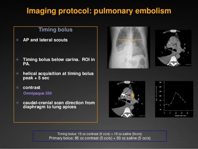 Copy of Mitsumori-CT angiography techniques