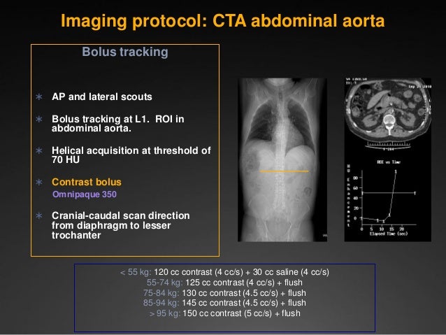Copy of Mitsumori-CT angiography techniques
