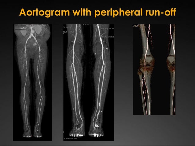 Copy of Mitsumori-CT angiography techniques