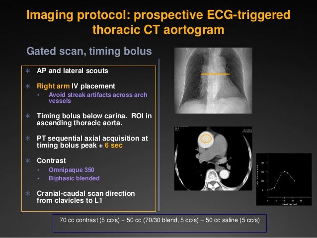 Copy of Mitsumori-CT angiography techniques