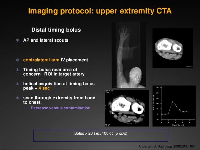 Copy of Mitsumori-CT angiography techniques