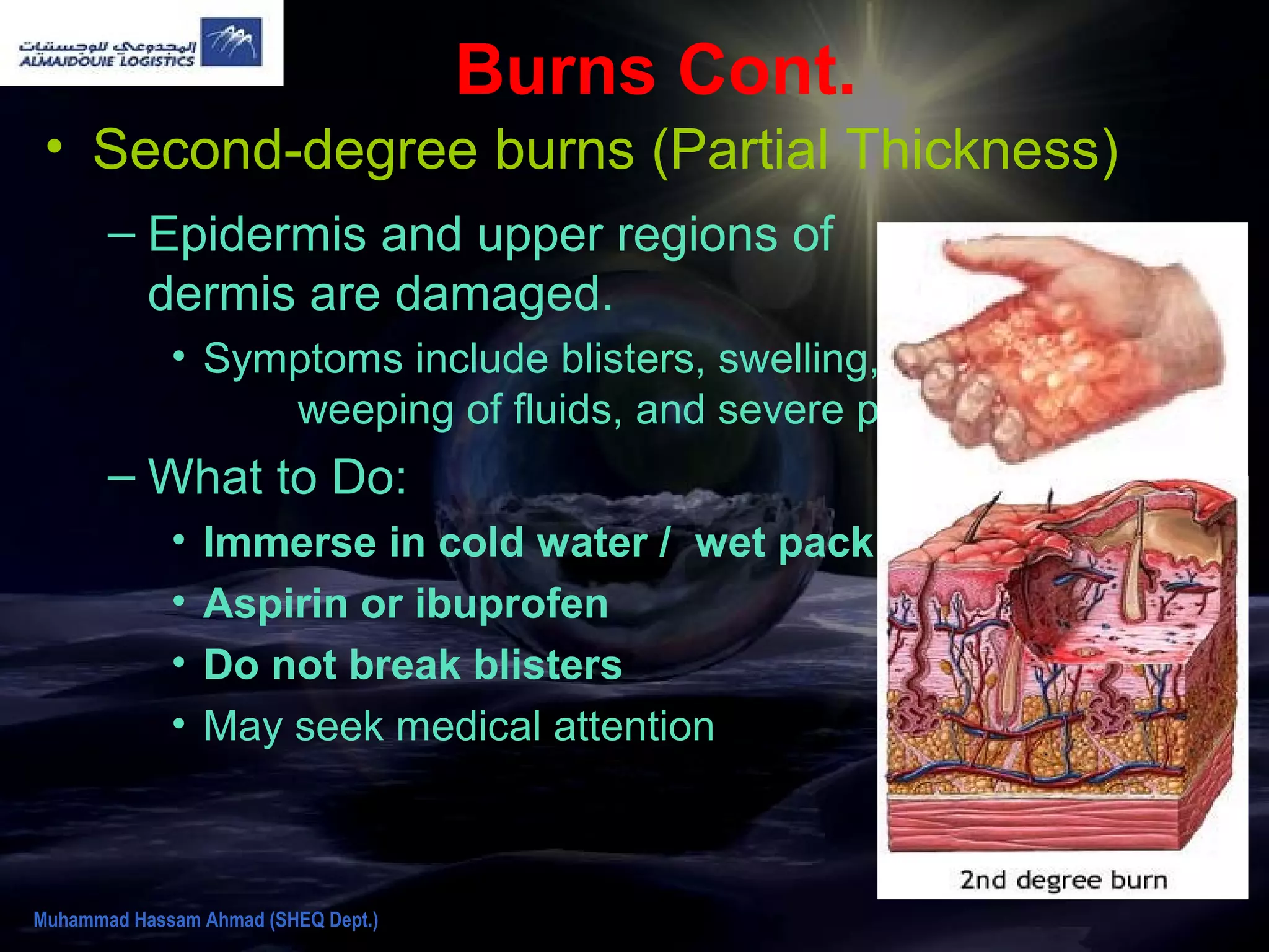 Basic First Aid. | PPT