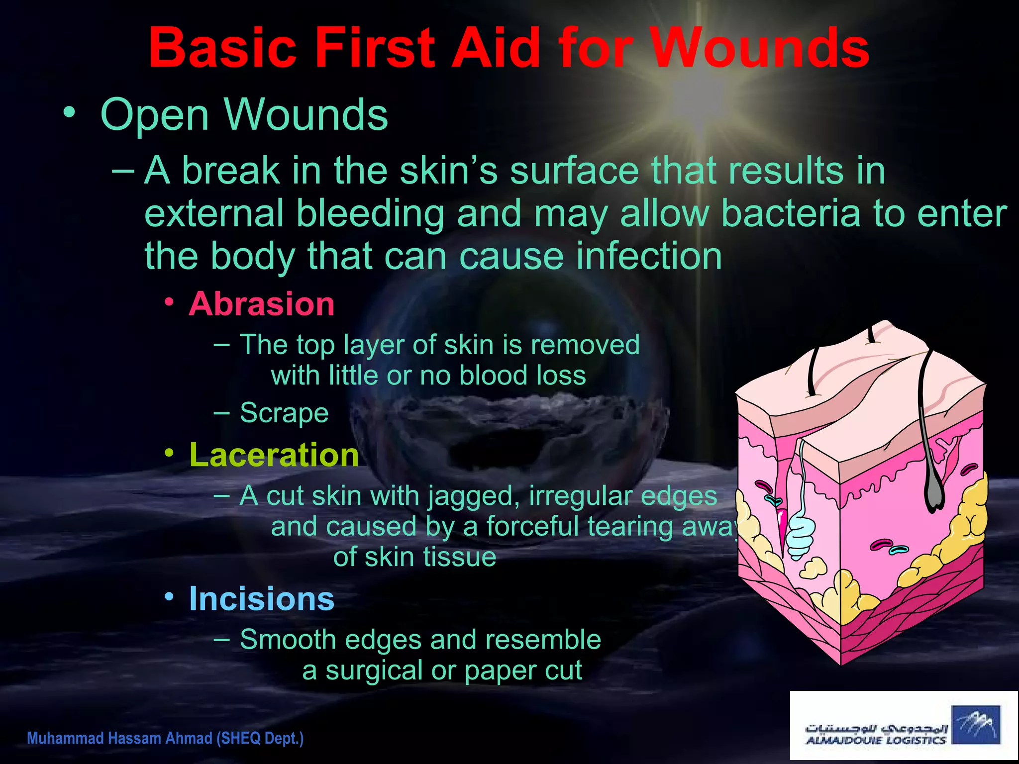 Basic First Aid. | PPT