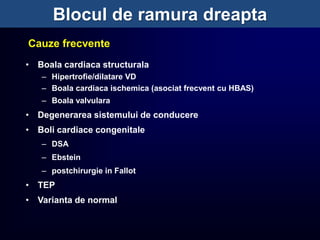 97693374-ECG-Curs-Aritmii.ppt