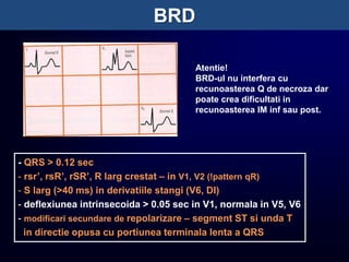 97693374-ECG-Curs-Aritmii.ppt
