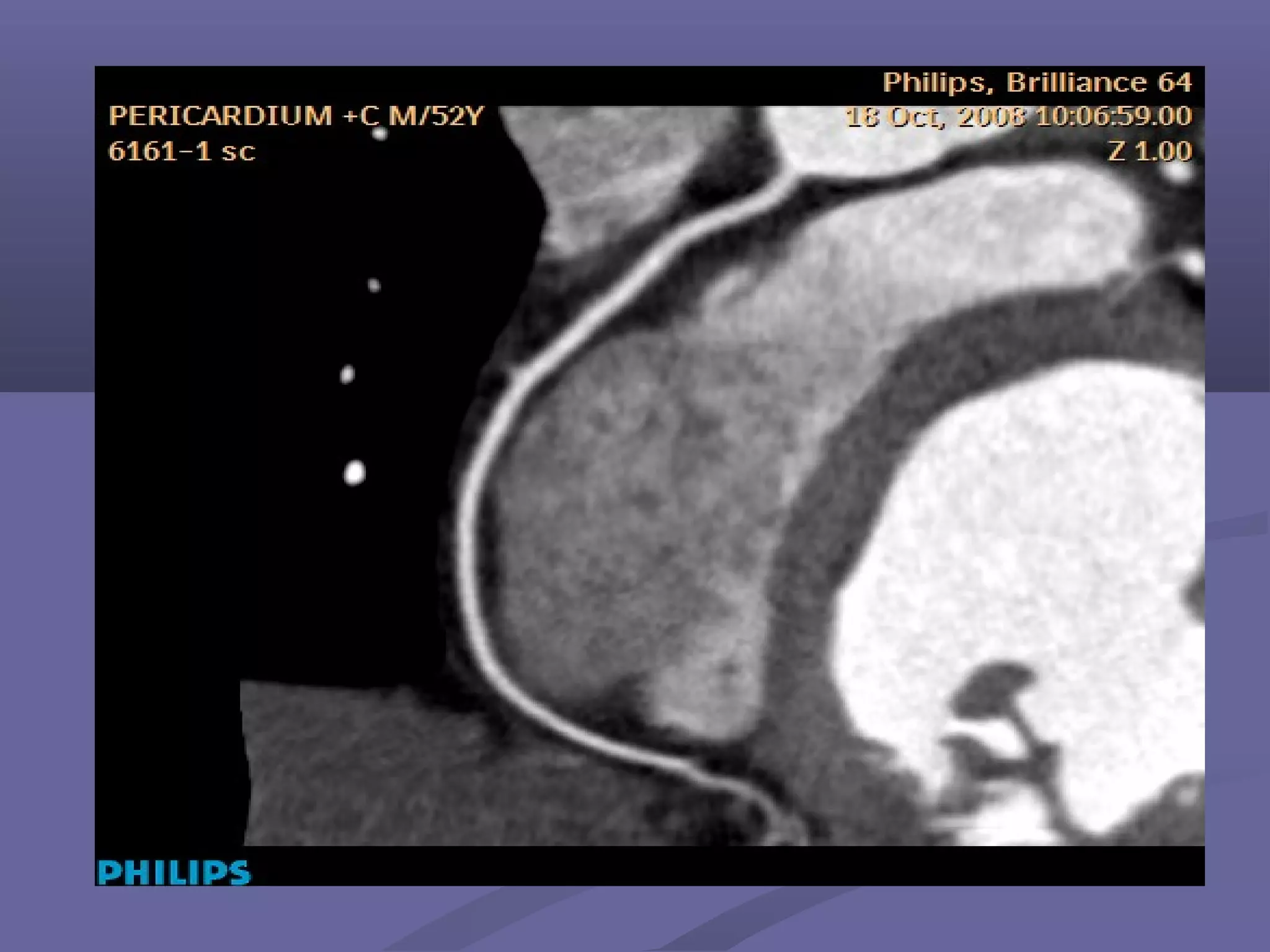 CARDIAC_CT_PRESENTATION | PPT