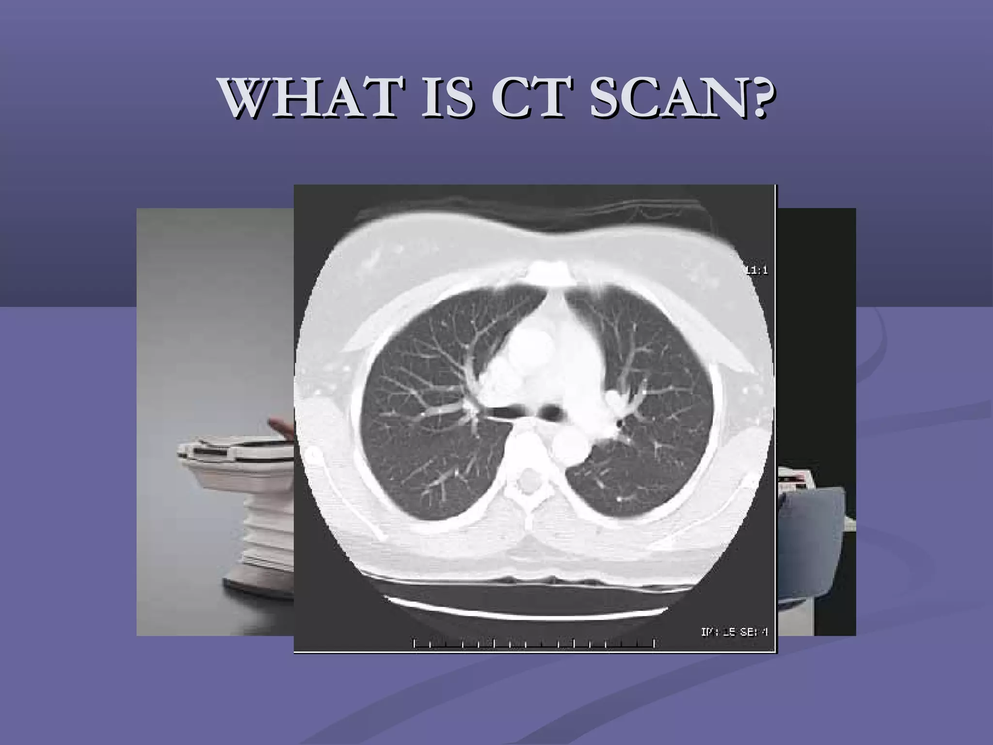 CARDIAC_CT_PRESENTATION | PPT