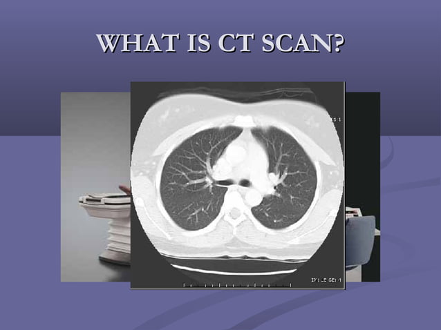 CARDIAC_CT_PRESENTATION | PPT