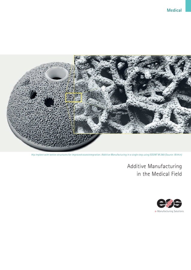 Additive Manufacturing in the Medical Field -EOS | PDF