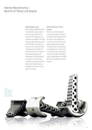 Additive Manufacturing in the Medical Field -EOS | PDF