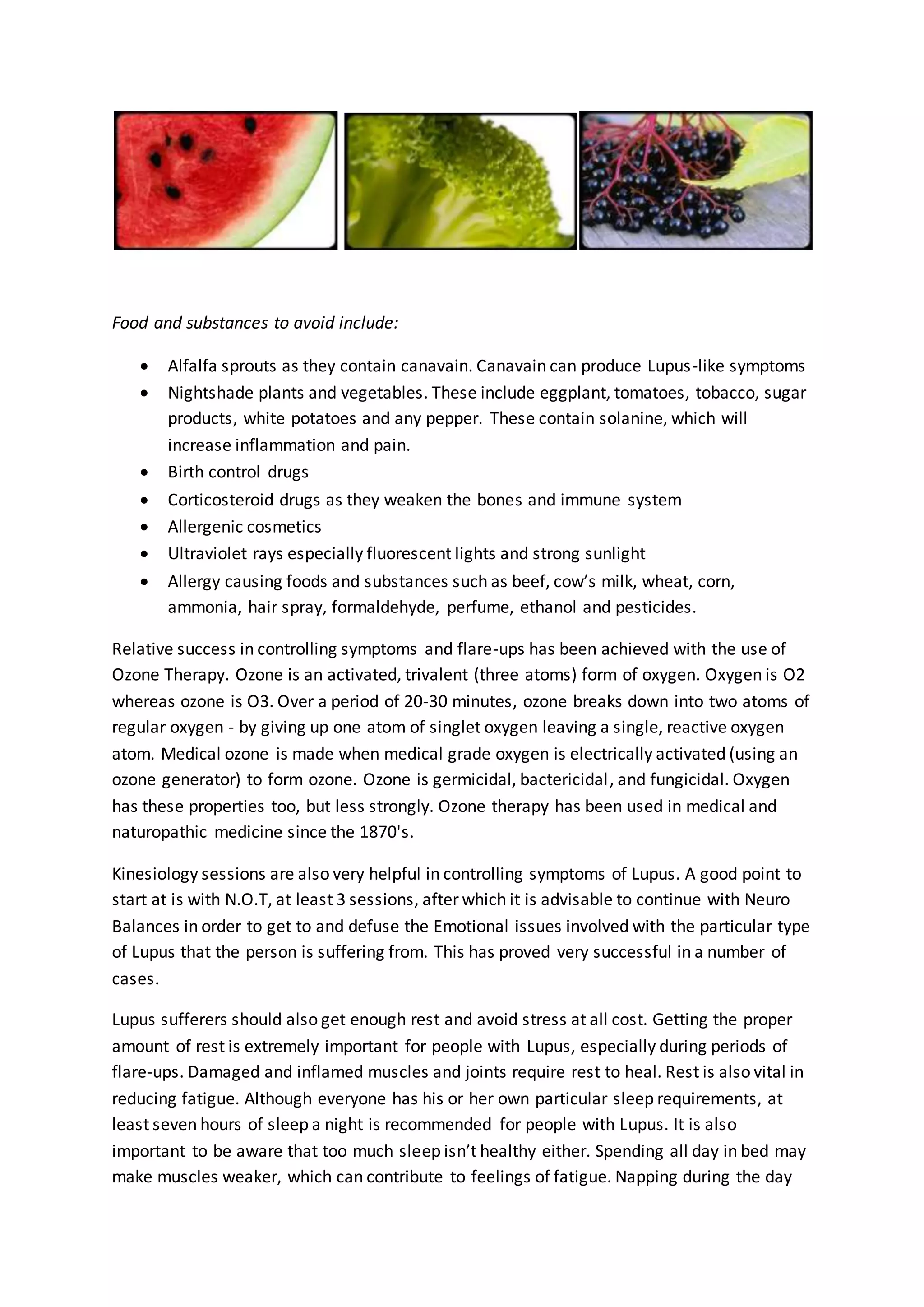 SYSTEMIC LUPUS ERYTHEMATOSIS - THESIS | DOCX