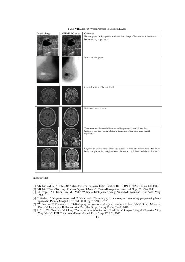 An Automatic Medical Image Segmentation using Teaching Learning Based…