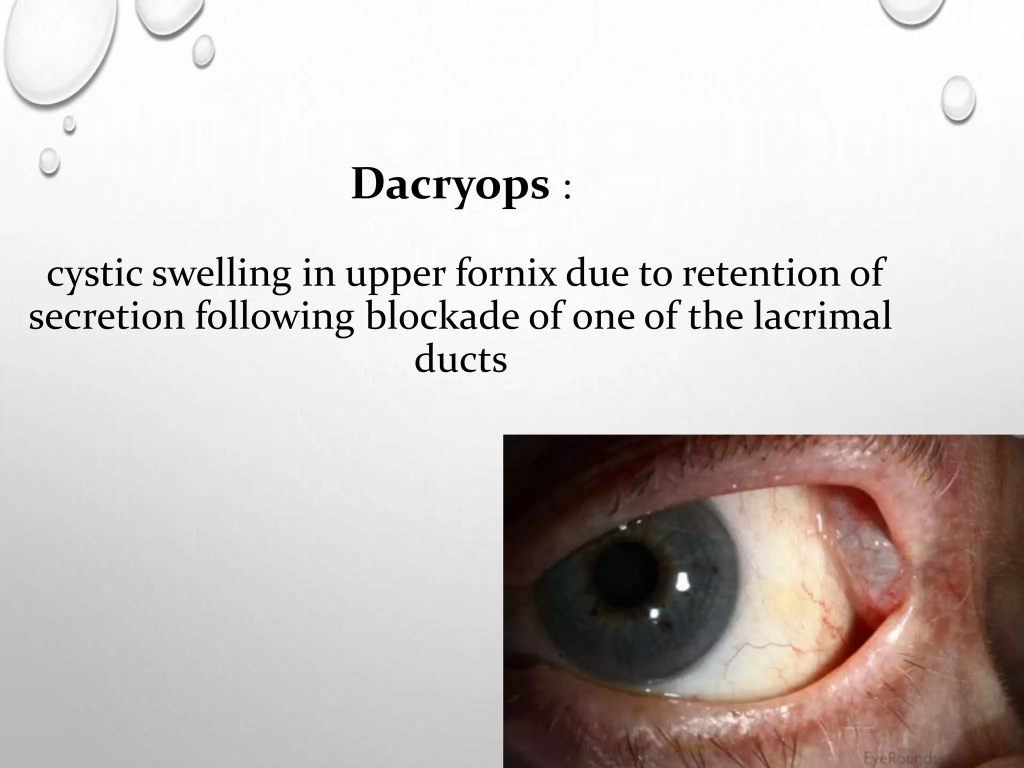Anatomy and Physiology of Lacrimal system | PPTX