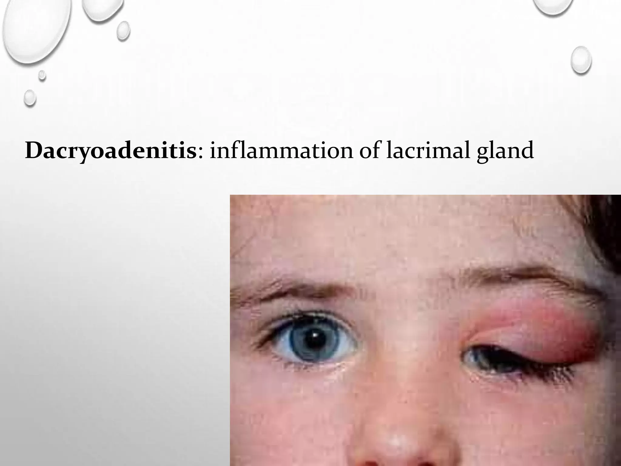 Anatomy and Physiology of Lacrimal system | PPTX