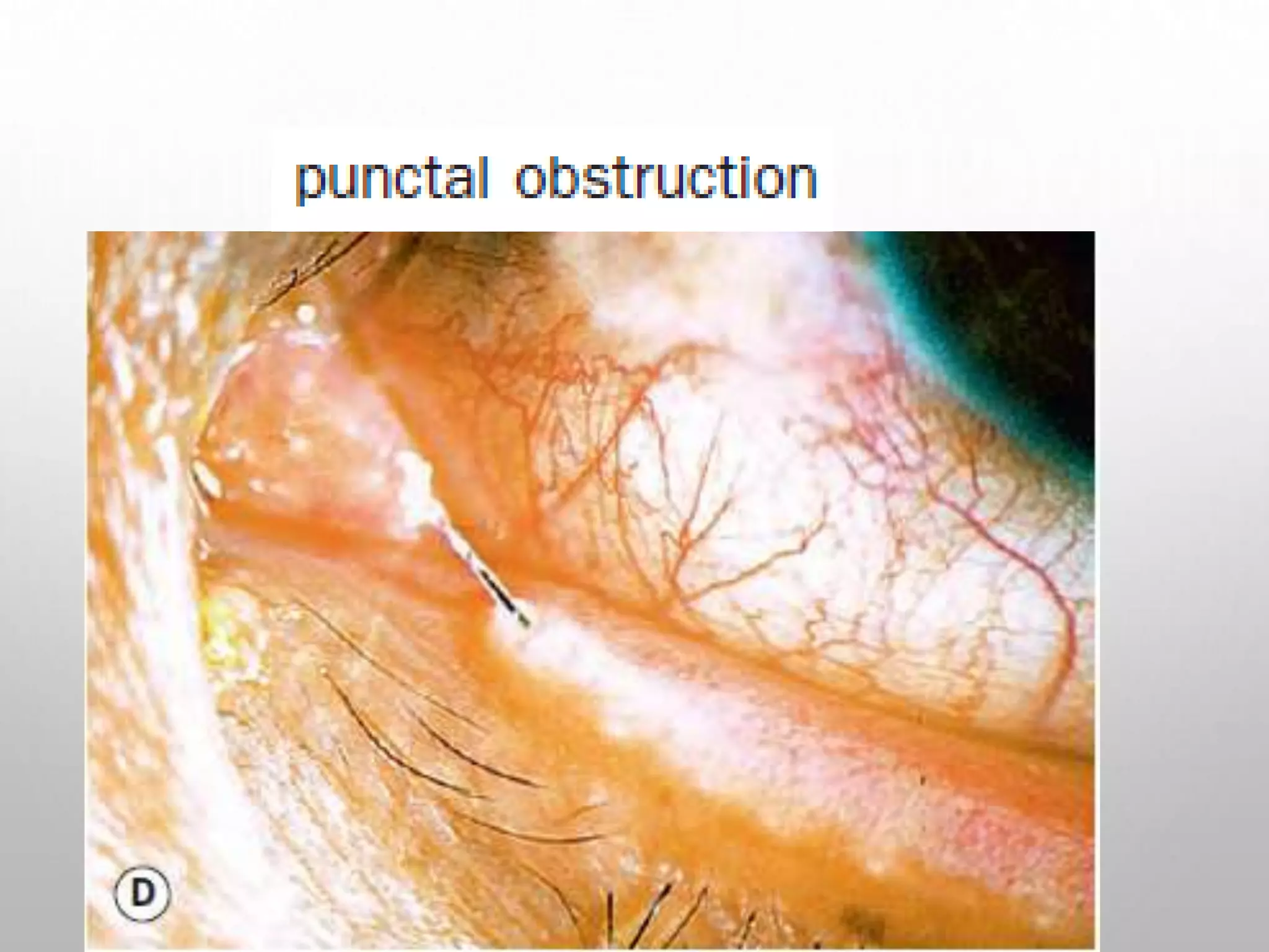 Anatomy and Physiology of Lacrimal system | PPTX