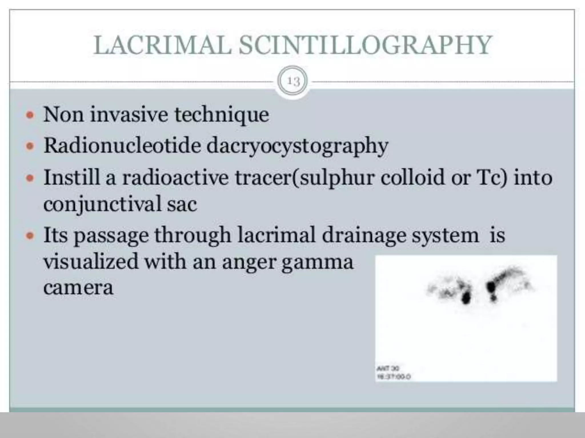 Anatomy and Physiology of Lacrimal system | PPTX