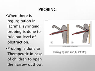 Anatomy and Physiology of Lacrimal system | PPTX