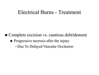 991115ElectricalBurn.pptx