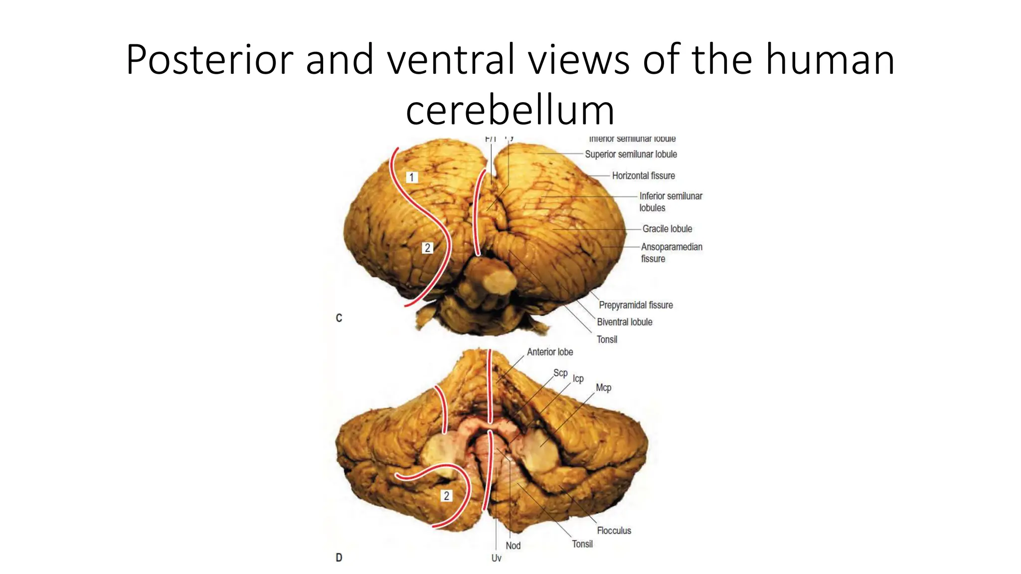 996_Cerebellum anatomy yes it is cerebellum.pptx