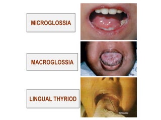 Tongue anatomy | PPT