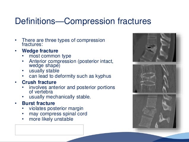 2017.01.25, Howard, LS-Spine