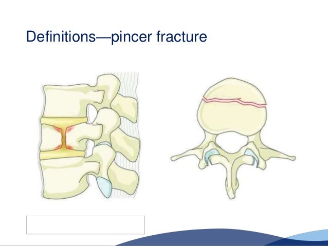 2017.01.25, Howard, LS-Spine