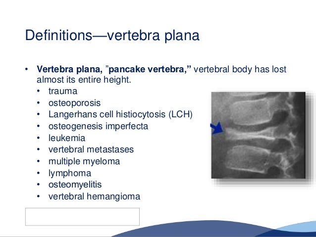 2017.01.25, Howard, LS-Spine