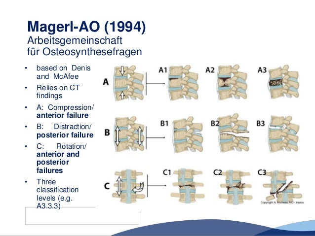 2017.01.25, Howard, LS-Spine