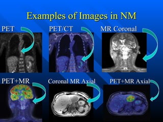 9A.INTRODUCTION TO NUCLEAR MEDICINE.pptm