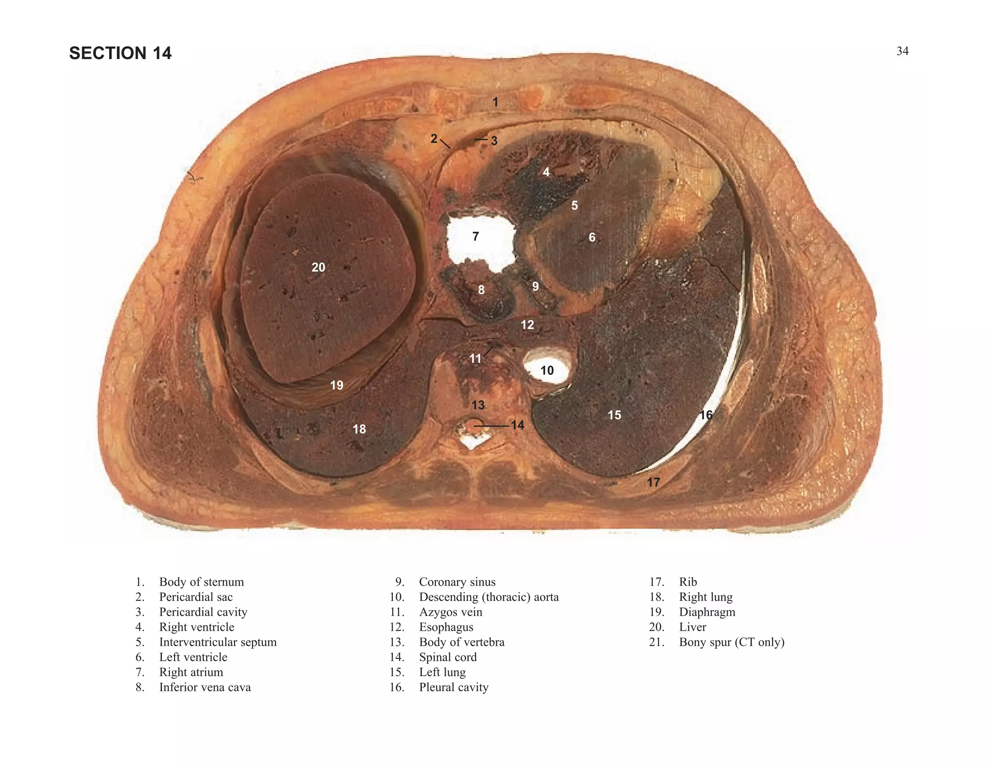 Miniatlas of Human Cross-Sectional Anatomy | PDF