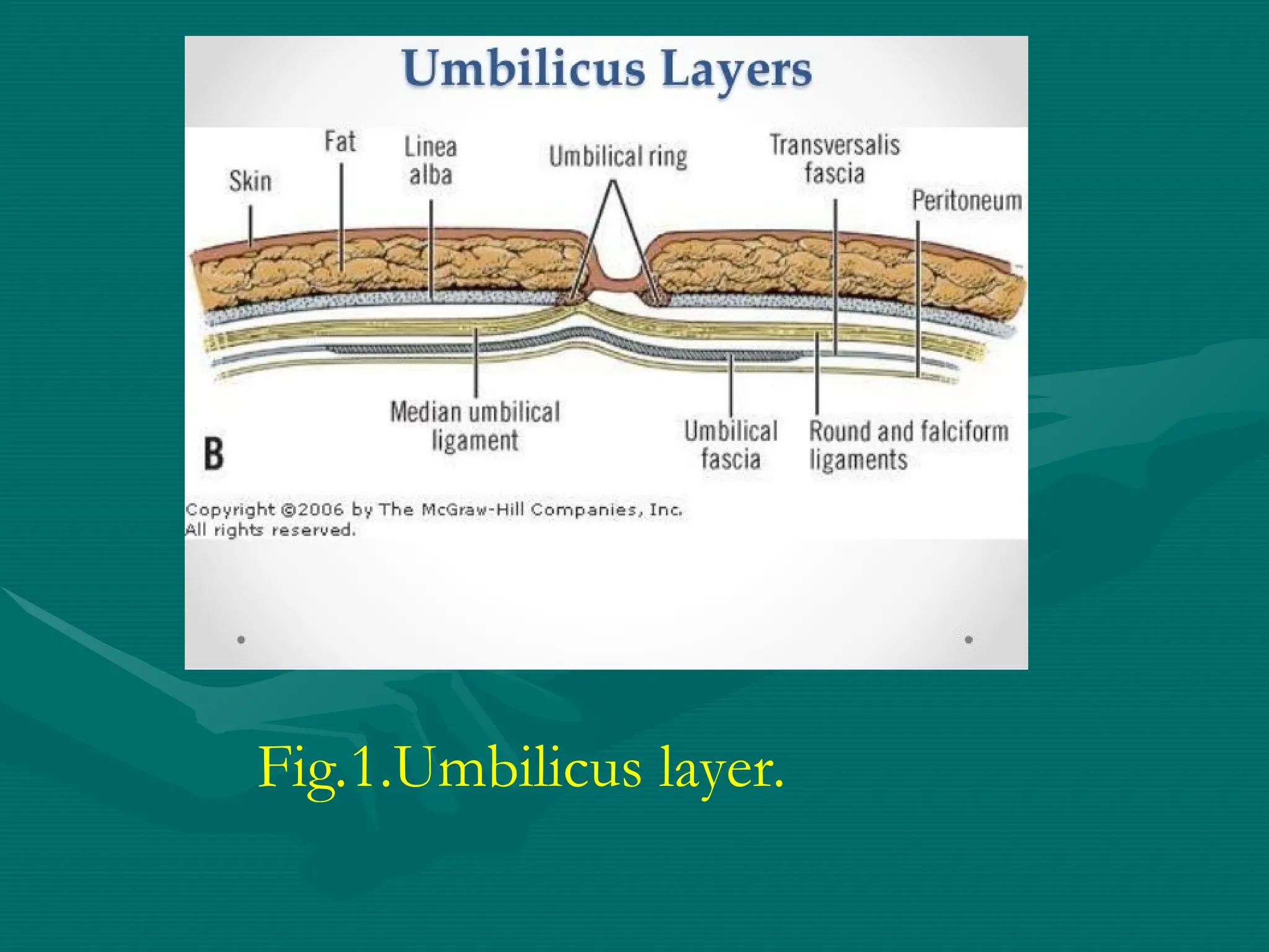 Abdominal wall hernia git system definition | PPT