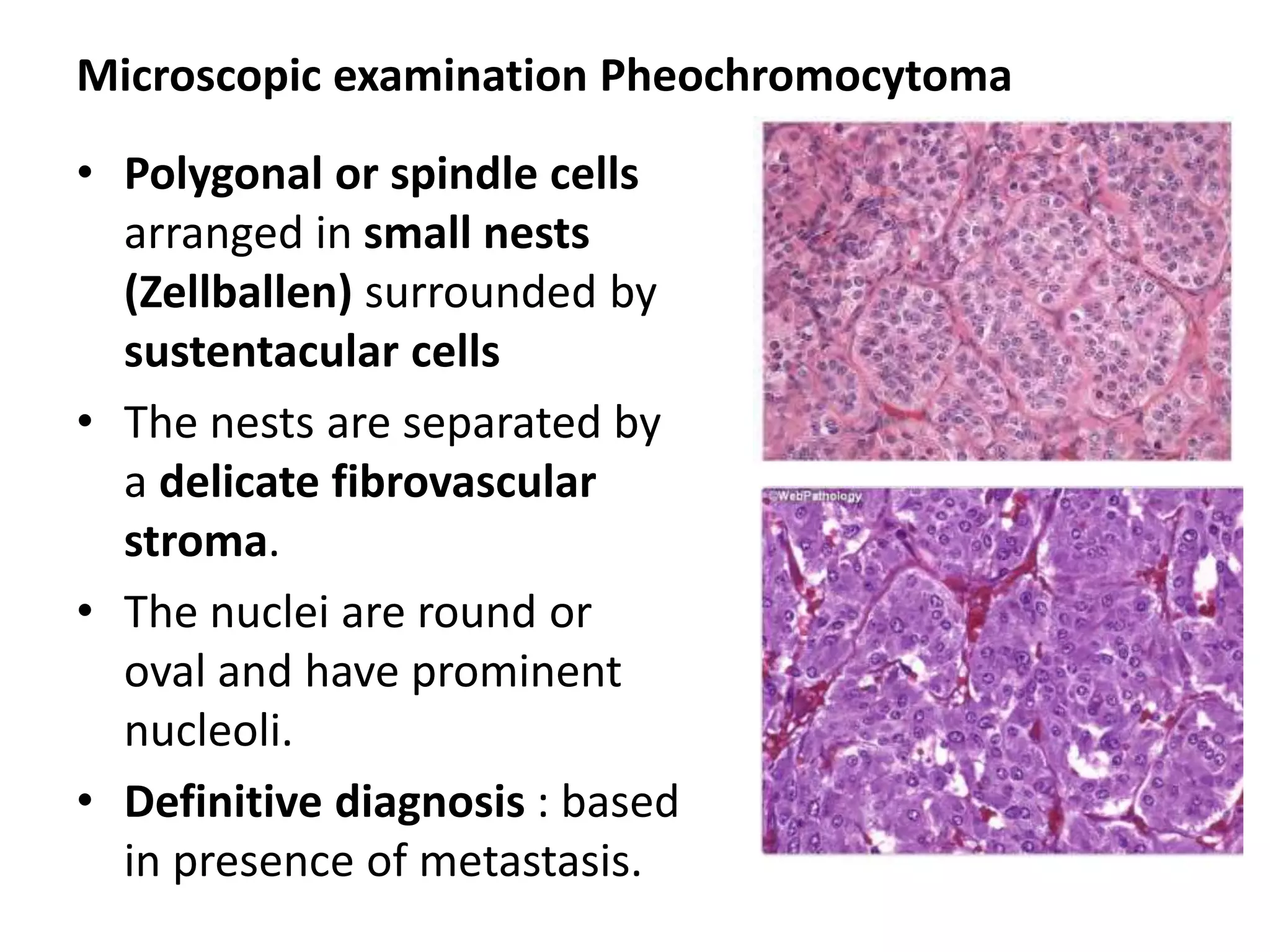 Adrenal Medulla.ppt