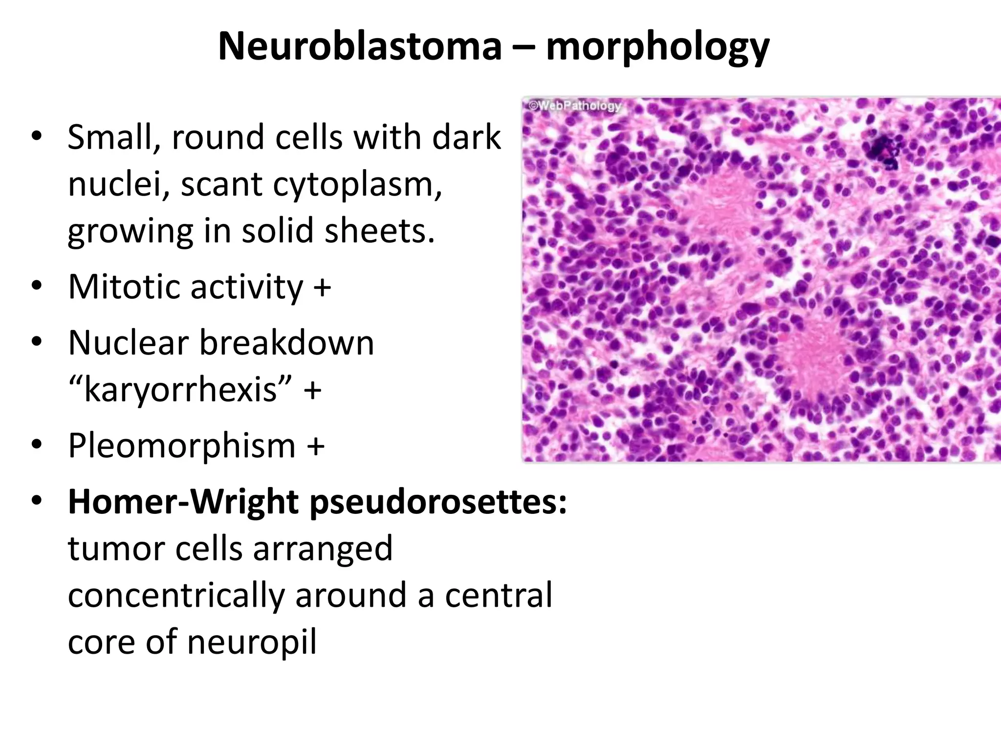 Adrenal Medulla.ppt
