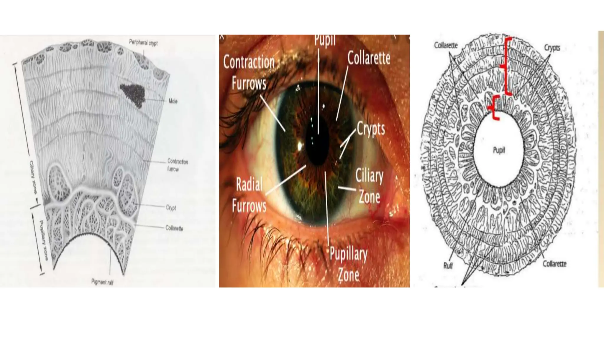 Anatomy of uvea UVEA of ophthalmology.pptx