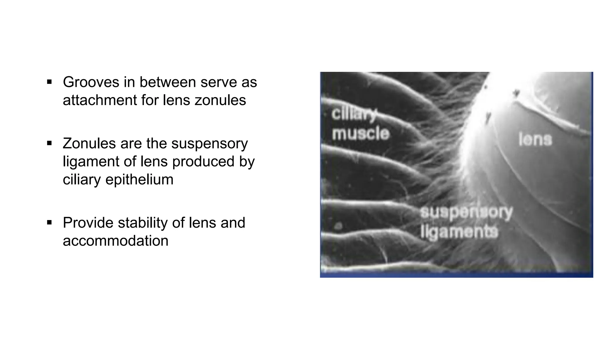 Anatomy of uvea UVEA of ophthalmology.pptx