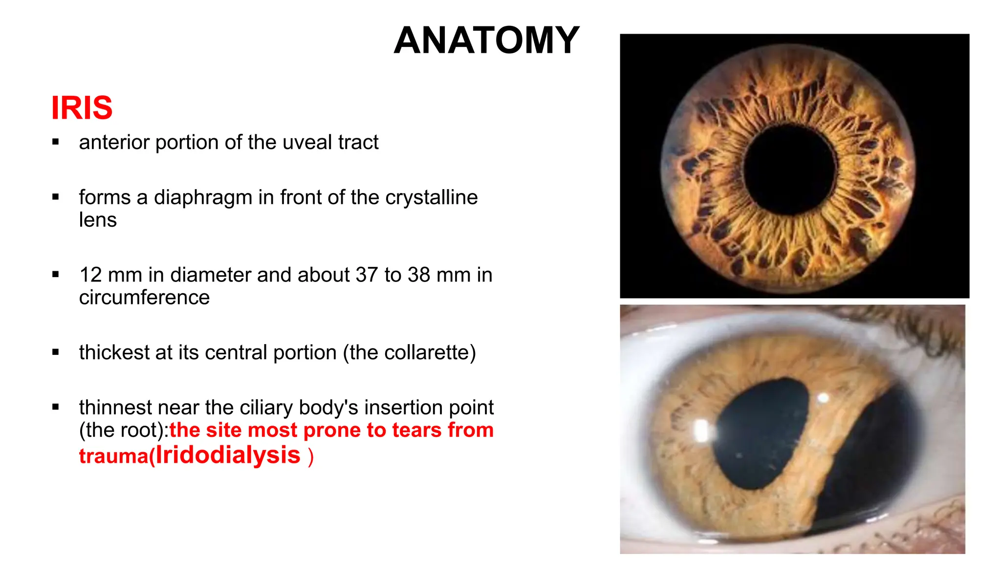 Anatomy of uvea UVEA of ophthalmology.pptx