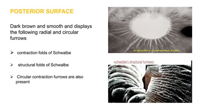 Anatomy of uvea UVEA of ophthalmology.pptx