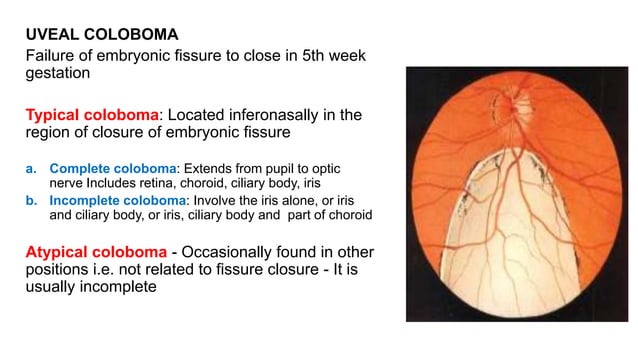 Anatomy of uvea UVEA of ophthalmology.pptx