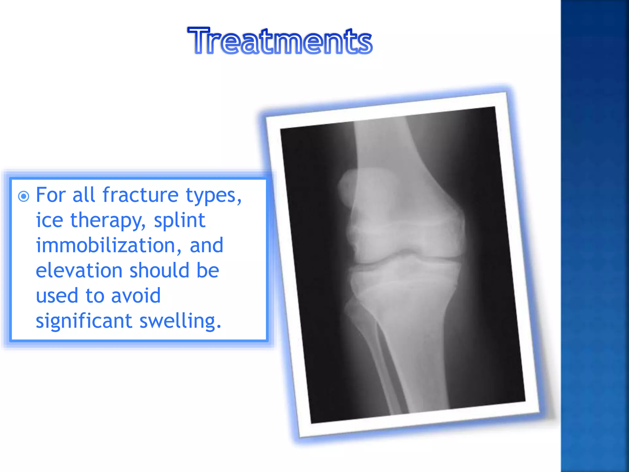 Tibial Tubercle Avulsion Fracture Powerpoint (1) | PPTX