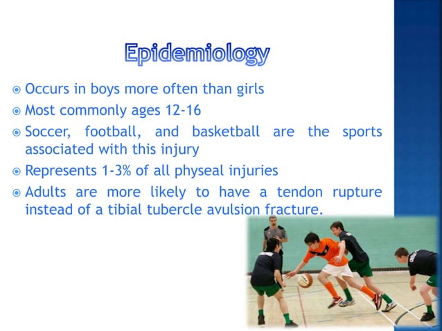 Tibial Tubercle Avulsion Fracture Powerpoint (1) | PPTX