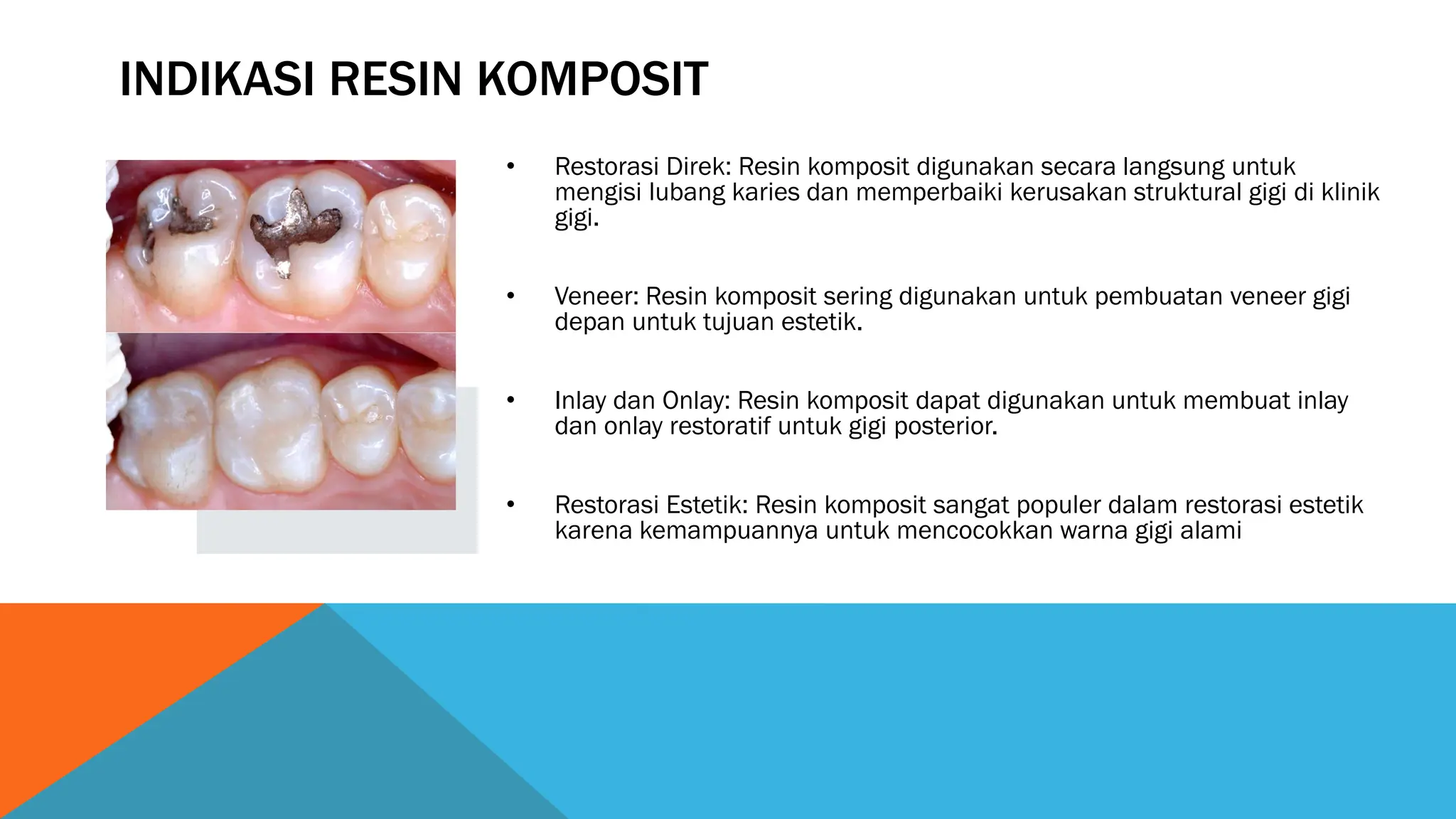 Ilmu biomaterial kedokteran gigi presentasi | PDF
