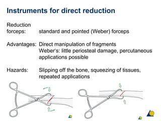 Surgical reduction techniques | PPT