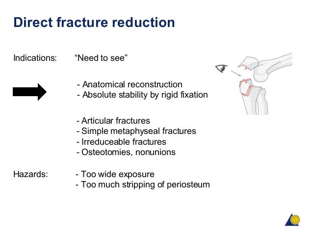 Surgical reduction techniques