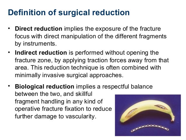 Surgical reduction techniques