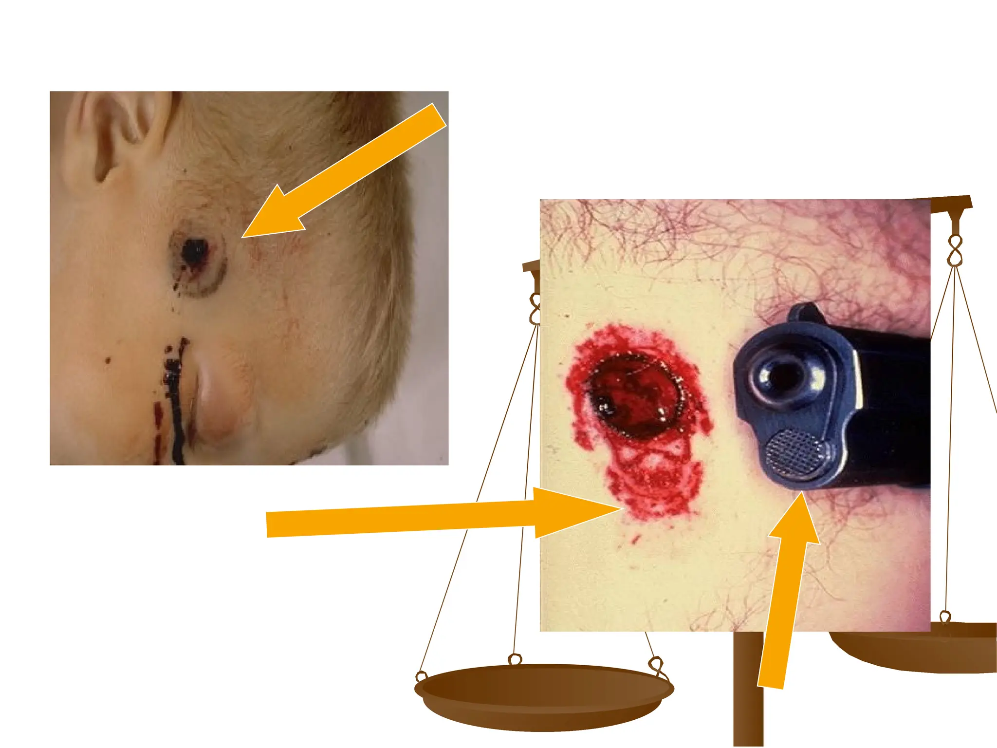 9CHARACTERS OF FIRE ARM INJURIES (WOUND).pptx