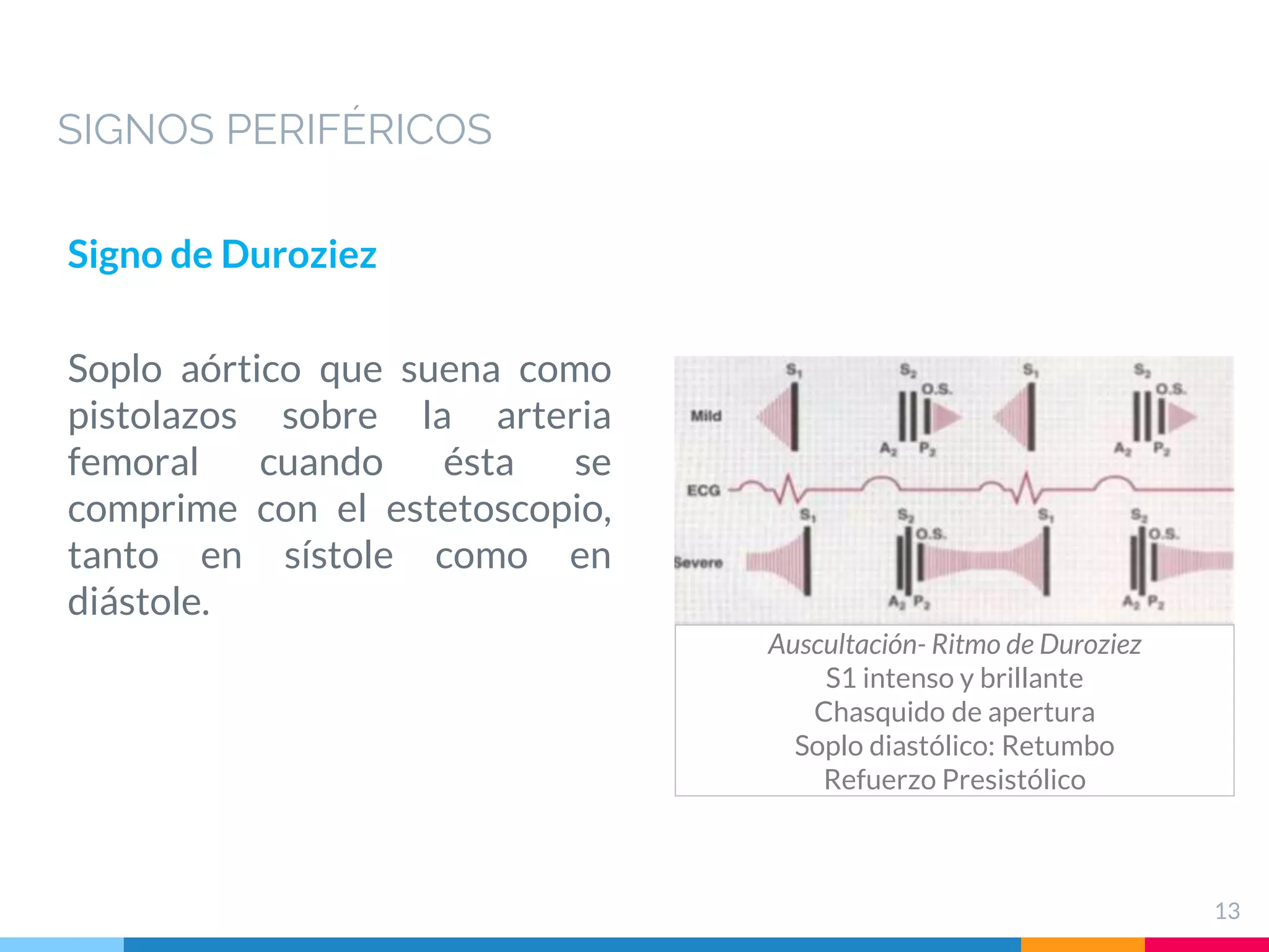 Signos y Síntomas de Insuficiencia Aórtica | PPTX