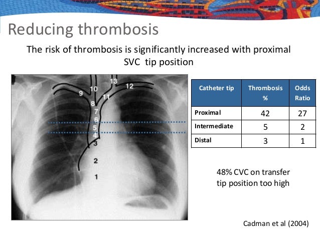 Complications of Central Venous Catheters: current perspectives